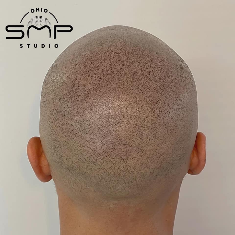 Experience Hair Transformation at Ohio SMP Studio in Columbus, OH