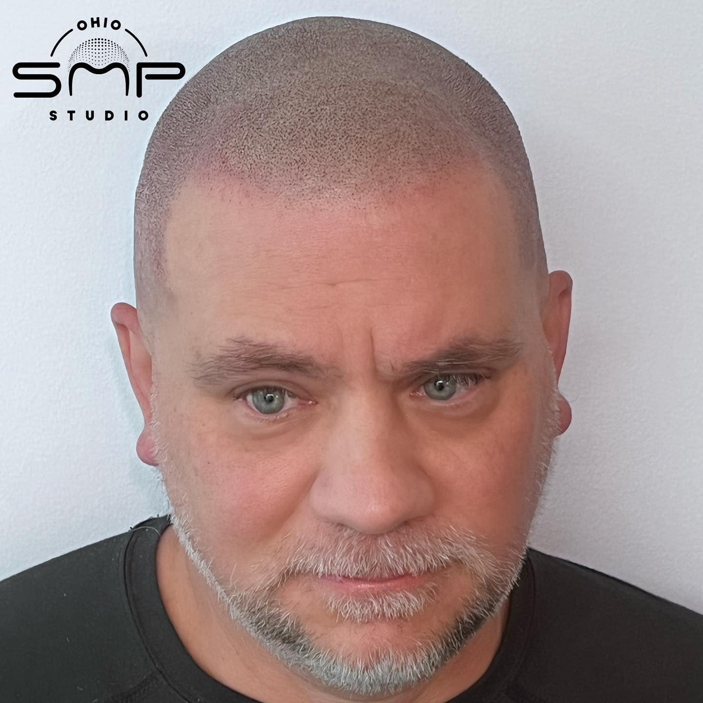 Mastering Hair Thinning Deciphering The Intricacies For Vibrant Hair Health In Columbus Oh